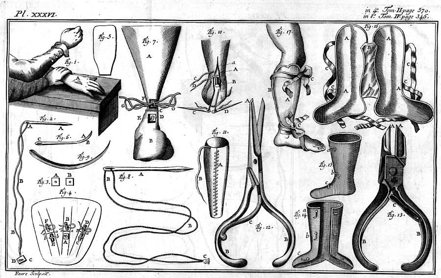 Gene surgery – Genchirurgie – Making Science Public